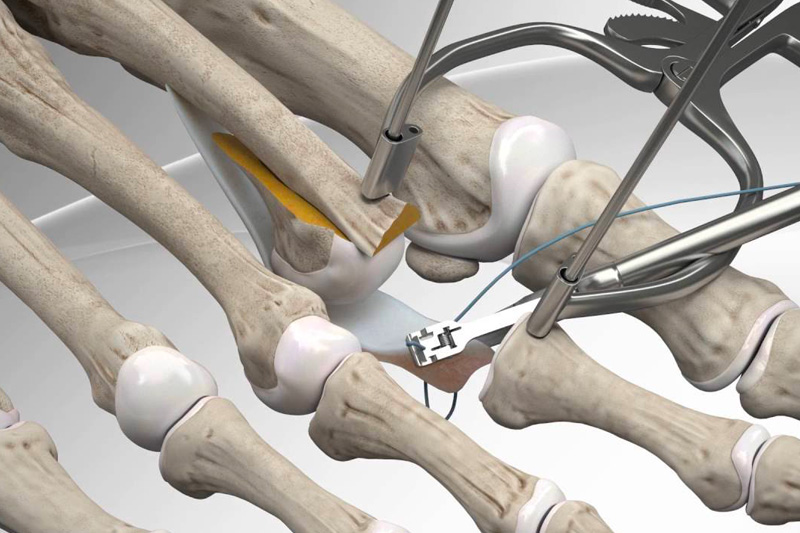 Sports Injuries - Kaitlin Neary MD